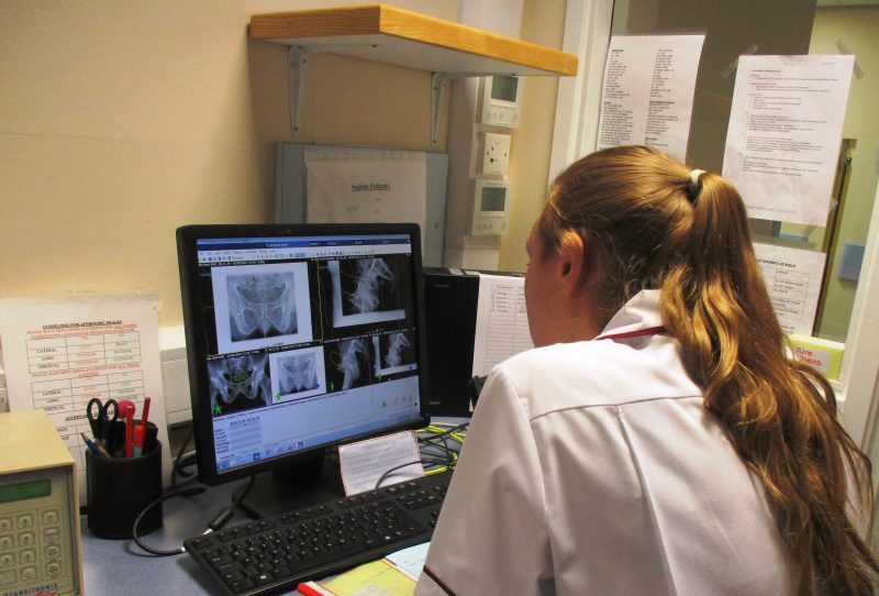 Your Radiotherapy Treatment – SaTH